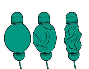Medicin i elastomerisk pumpe - Regionshospitalet Randers